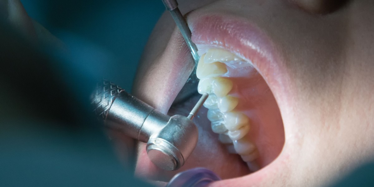 Endodoncia: ¿Qué es y para qué se realiza?
