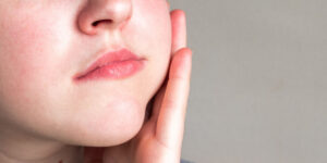 Flemón: Causas, síntomas y tratamiento