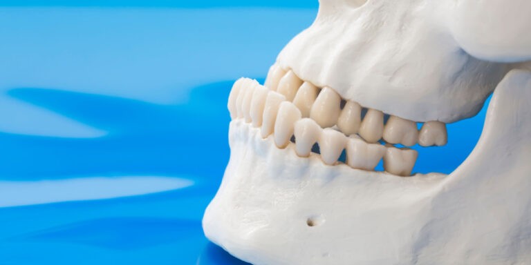 Prognatismo: Sobre este problema mandibular