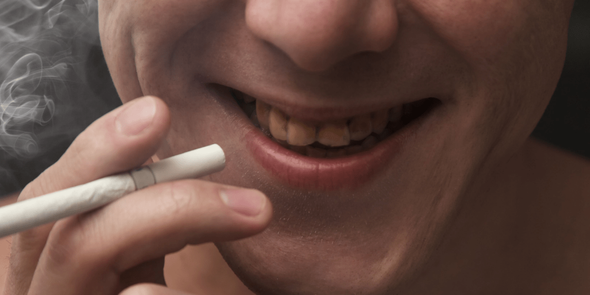 Efectos Del Tabaquismo En La Boca TABACO Y ENFERMEDAD PERIODONTAL